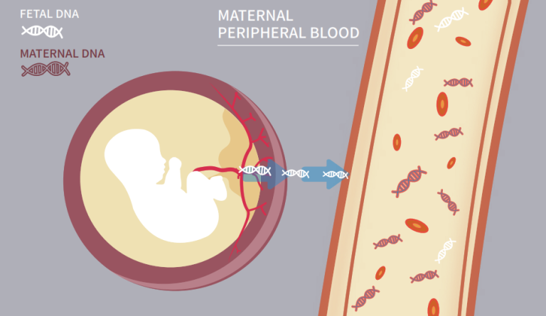 Prenatal Genetic Screening | Genomics